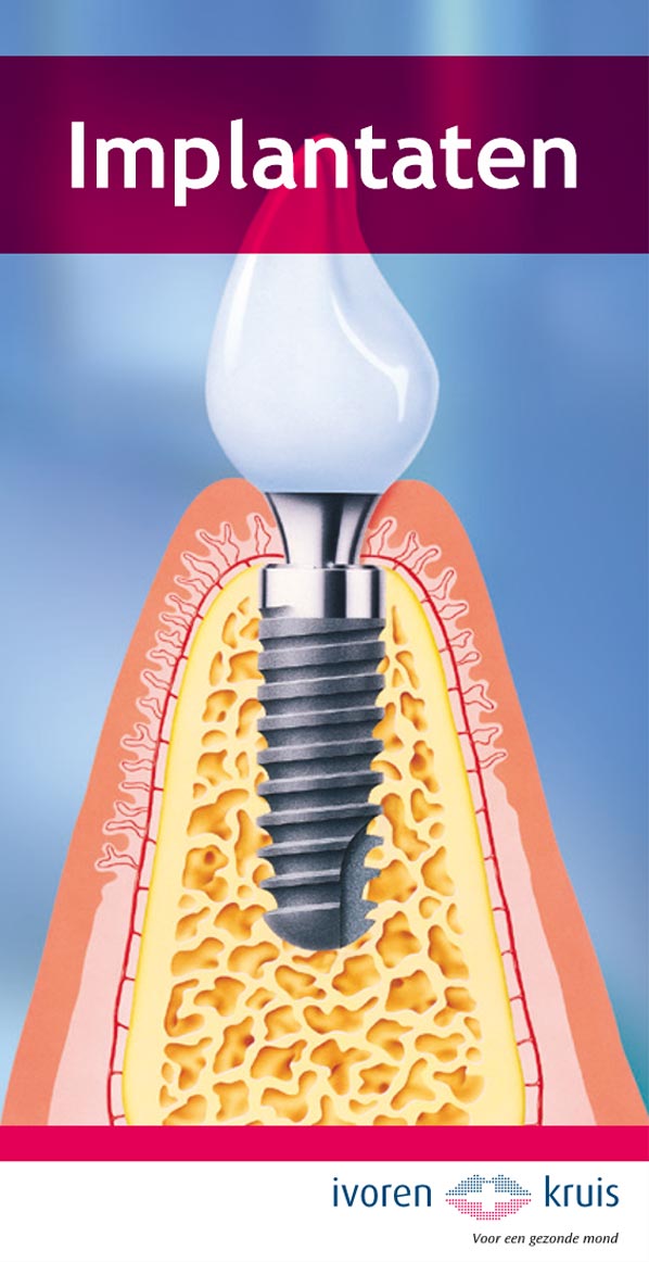 Behandelingen en voorlichting | Tandheelkundig Centrum Heemskerk